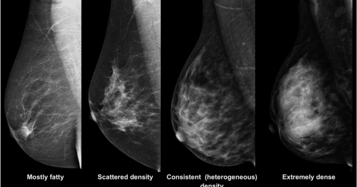 AI may help doctors identify… | Central Adelaide Local Health Network